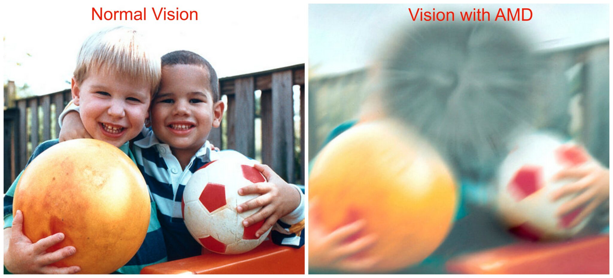 Retina Services Philadelphia | Philadelphia Eye Associates