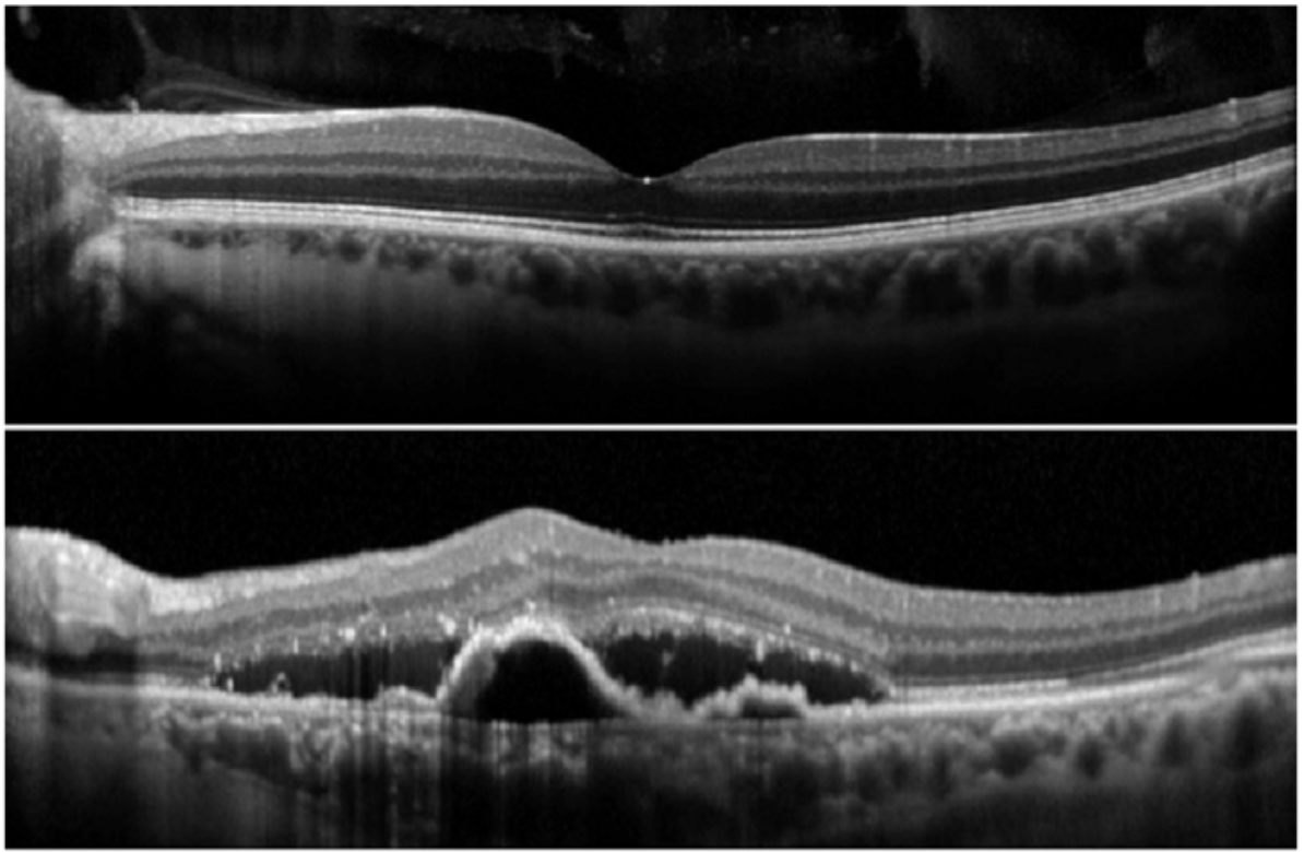 Retina Services Philadelphia | Philadelphia Eye Associates