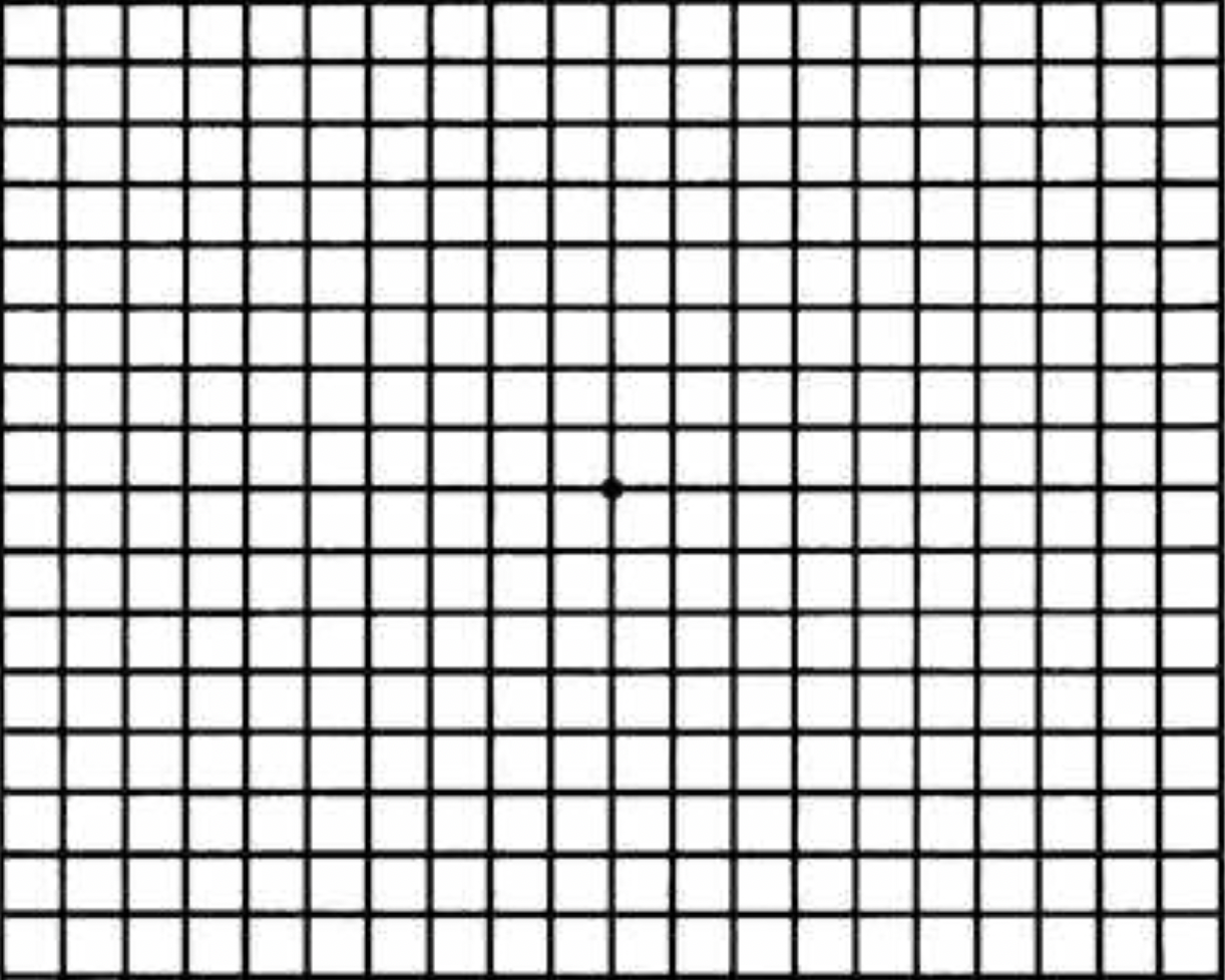 Retina Services Philadelphia | Philadelphia Eye Associates